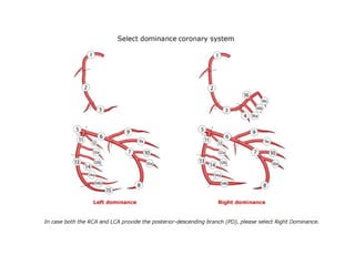 Revascularization in CCS according to 2018 ESC revascularization ...