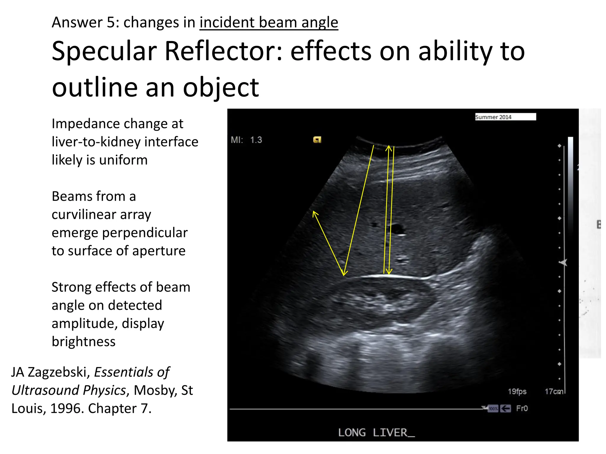 Reverberation Artifacts in ultrasound imaging | PDF