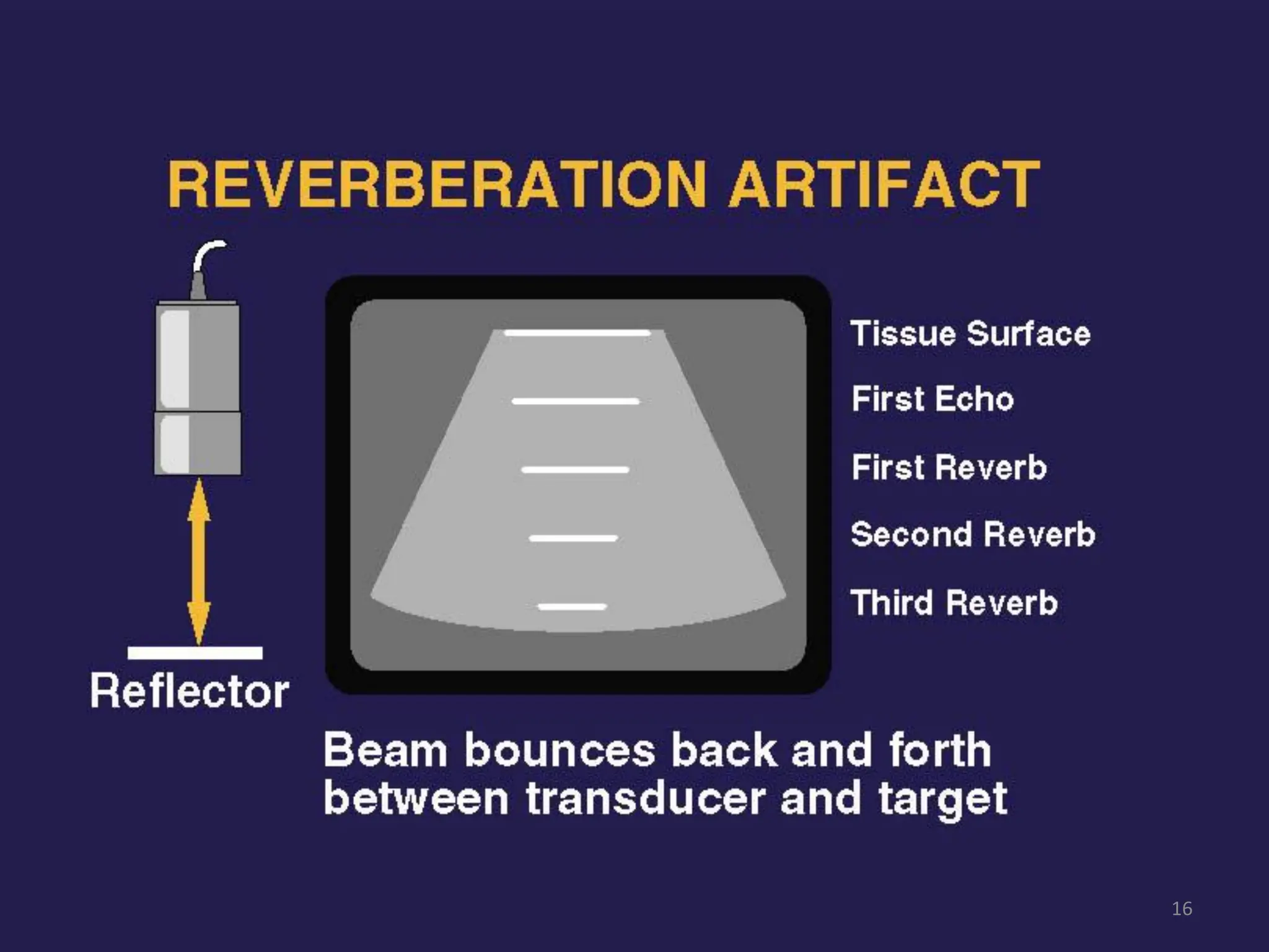 Reverberation Artifacts in ultrasound imaging | PDF