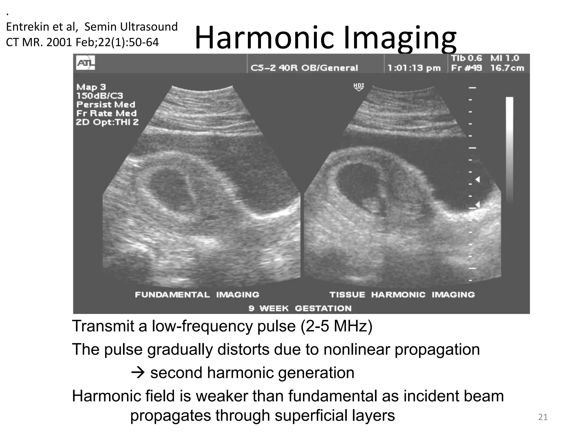 Reverberation Artifacts in ultrasound imaging | PDF