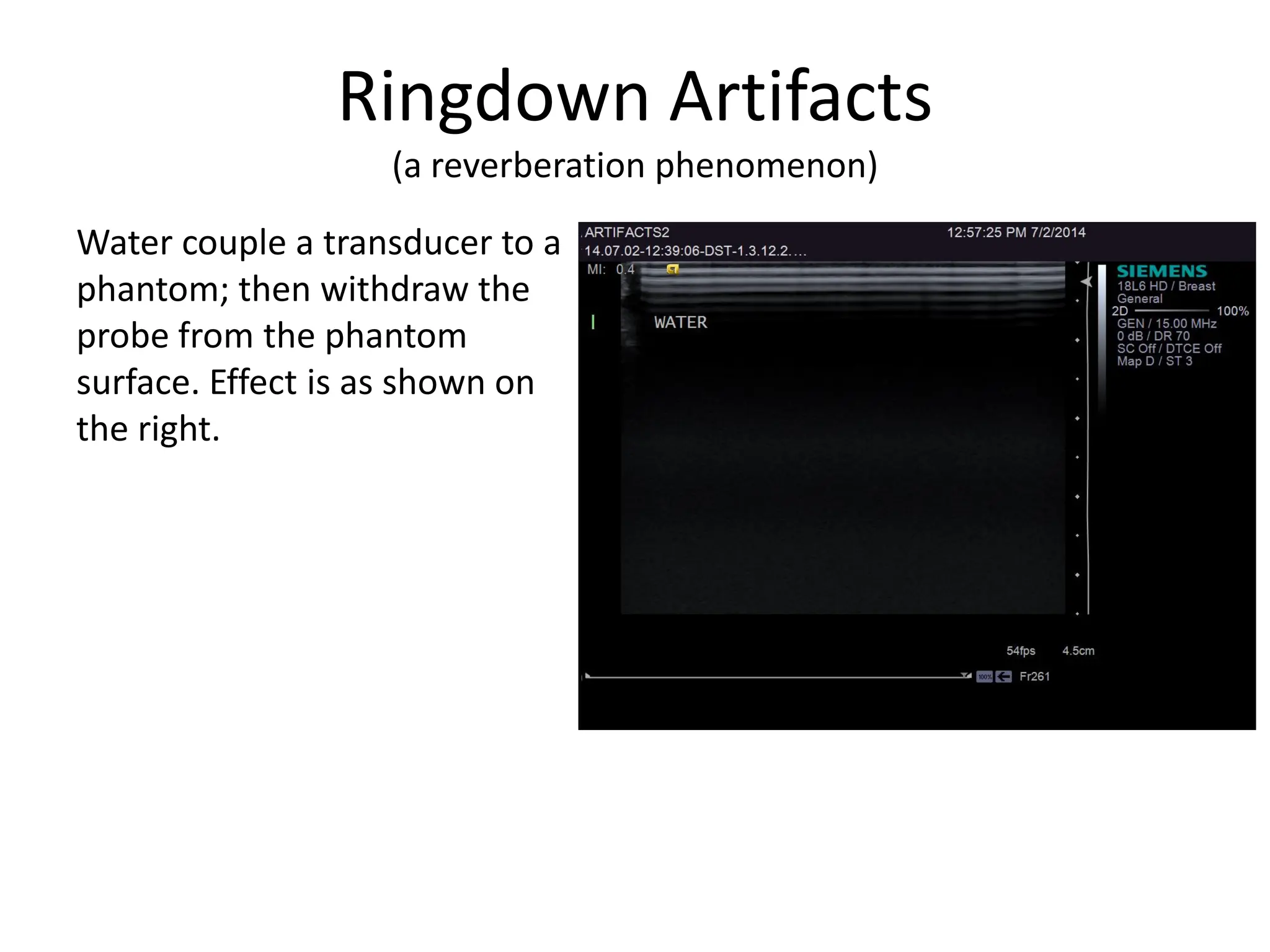 Reverberation Artifacts in ultrasound imaging | PDF