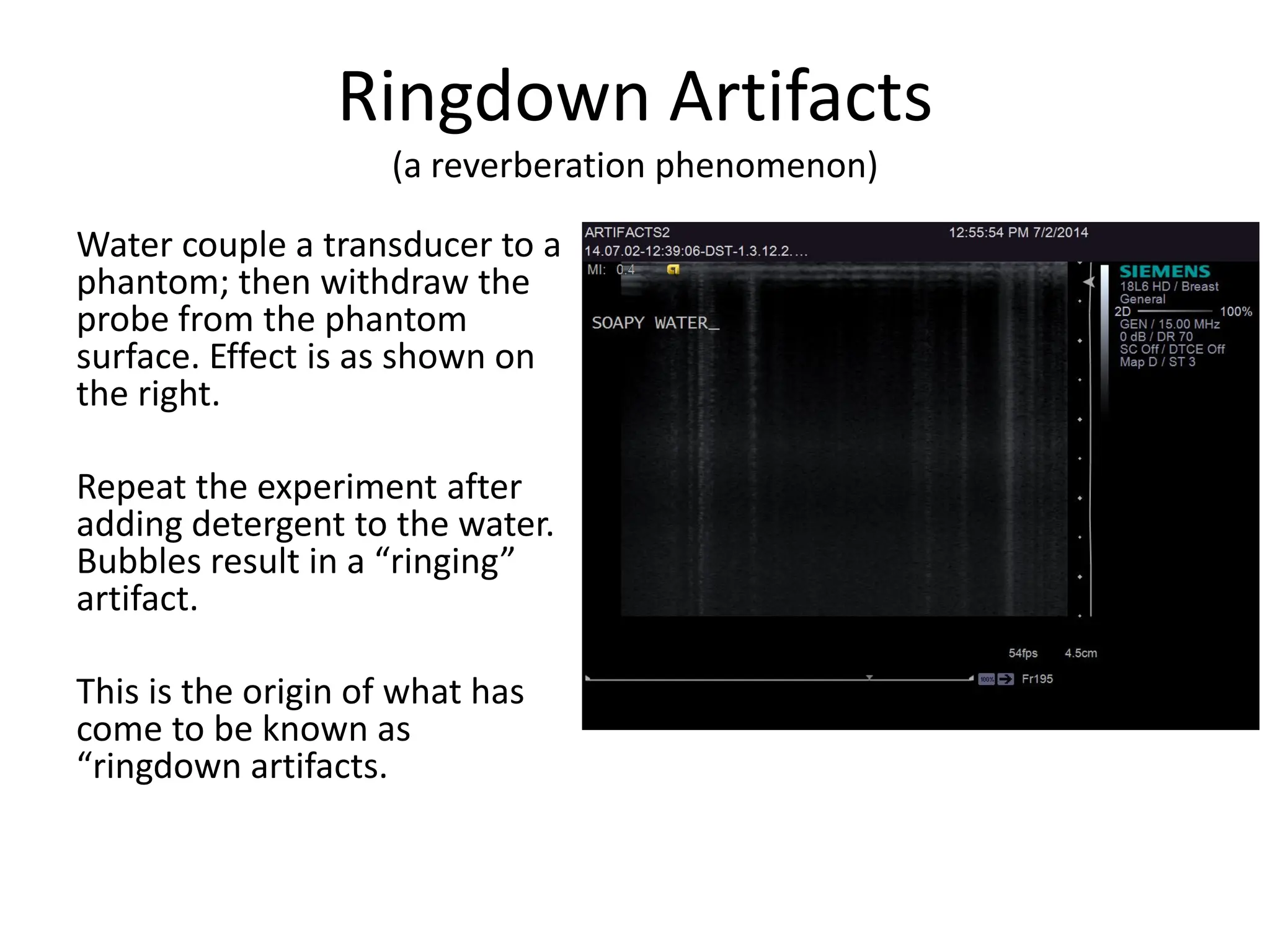 Reverberation Artifacts in ultrasound imaging | PDF