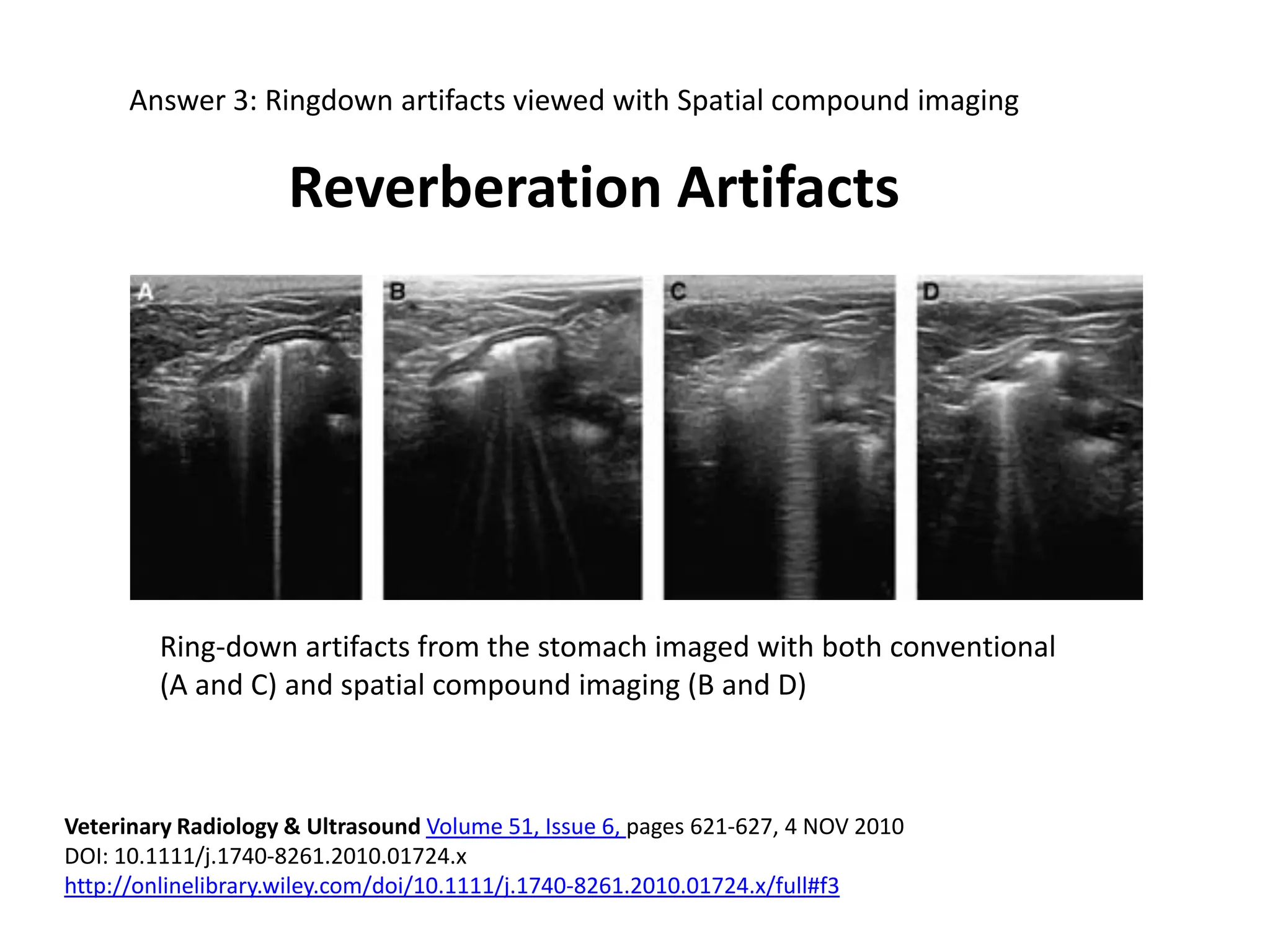 Reverberation Artifacts in ultrasound imaging | PDF