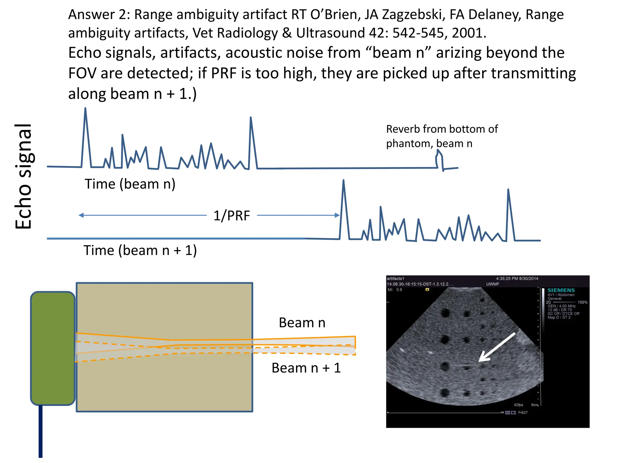 Reverberation Artifacts in ultrasound imaging | PDF