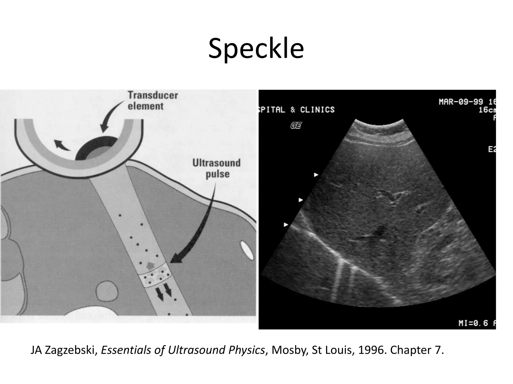 Reverberation Artifacts in ultrasound imaging | PDF