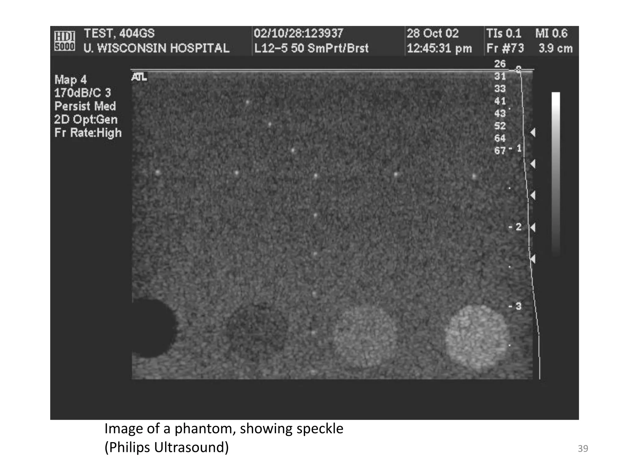 Reverberation Artifacts in ultrasound imaging | PDF