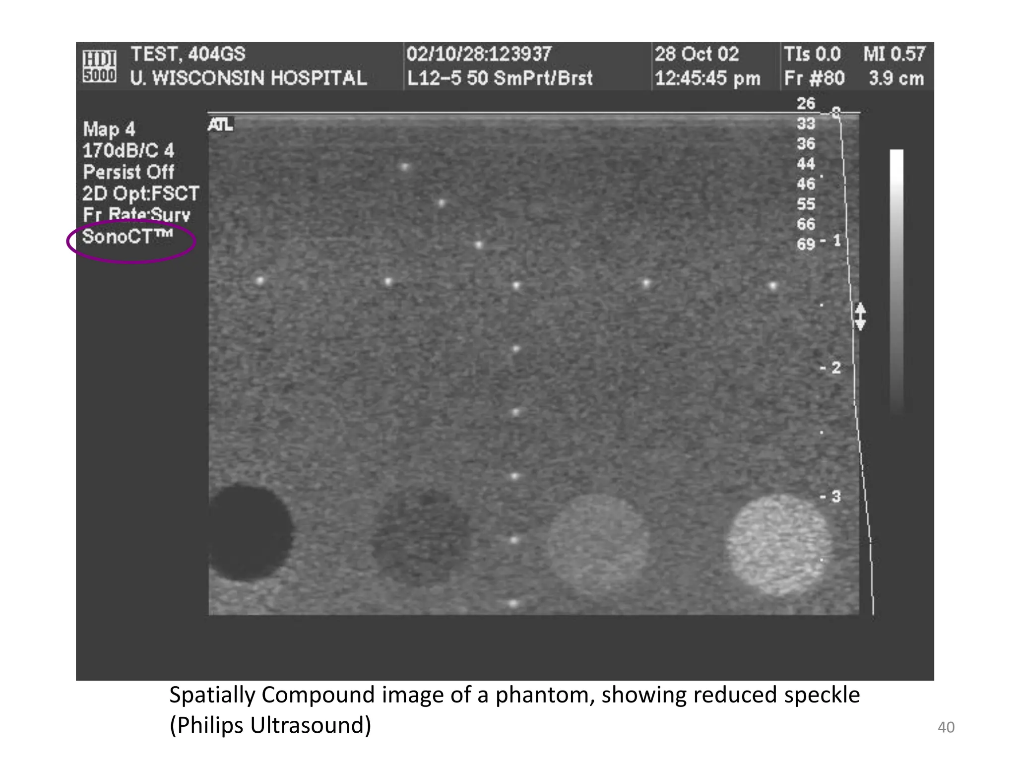 Reverberation Artifacts in ultrasound imaging | PDF
