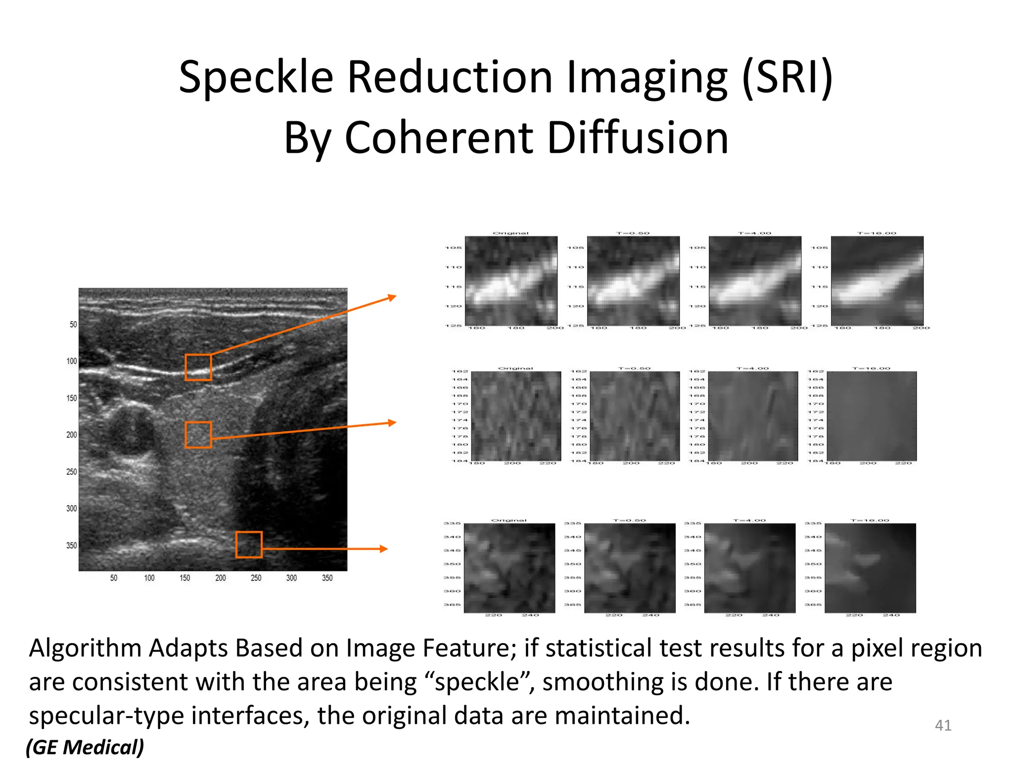 Reverberation Artifacts in ultrasound imaging | PDF