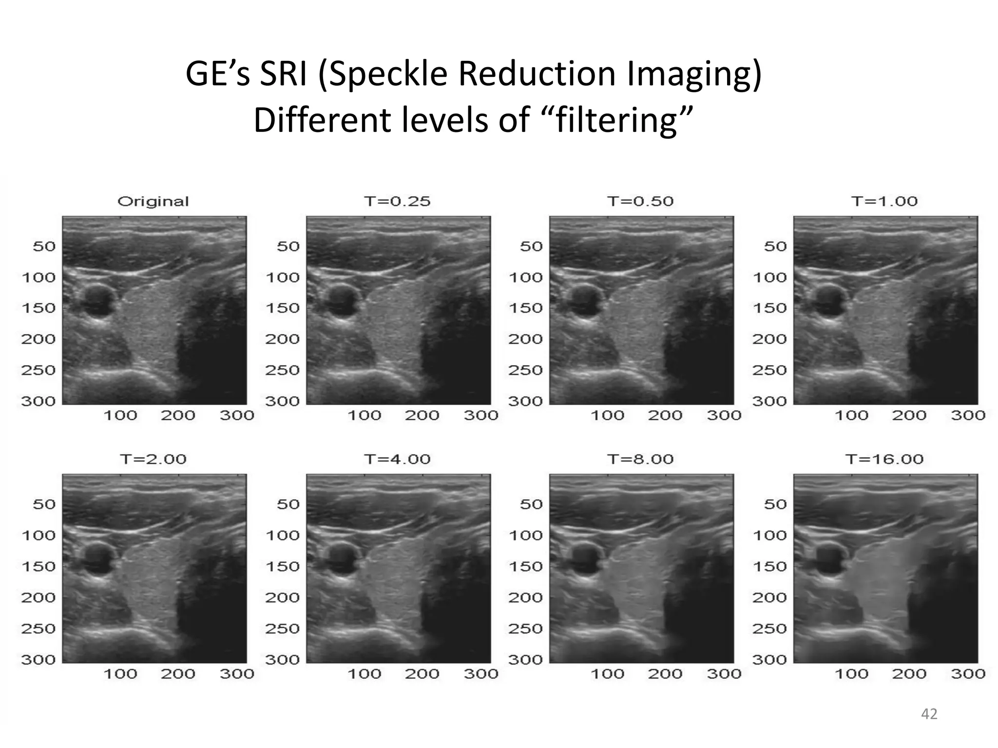 Reverberation Artifacts in ultrasound imaging | PDF