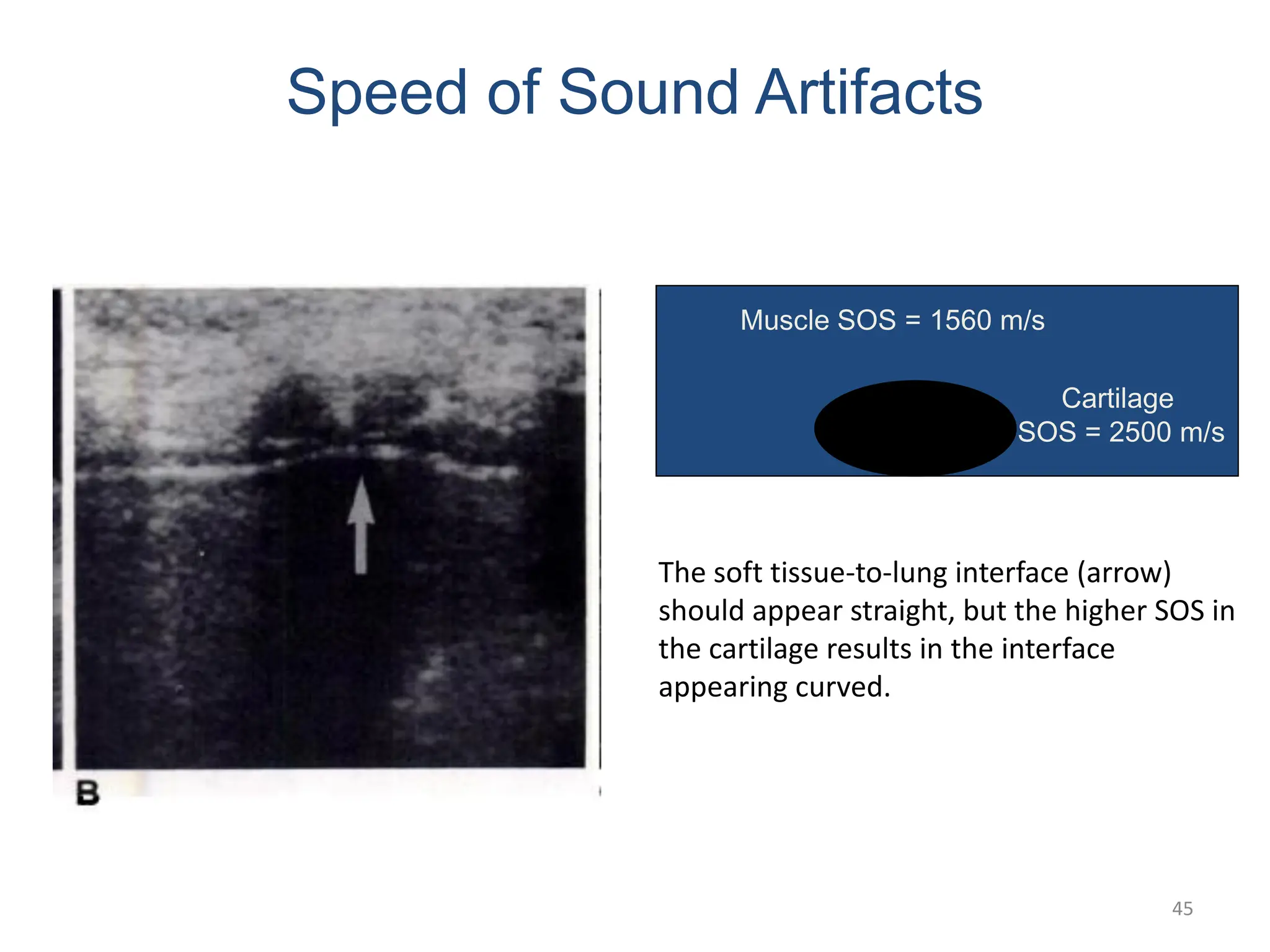 Reverberation Artifacts in ultrasound imaging | PDF