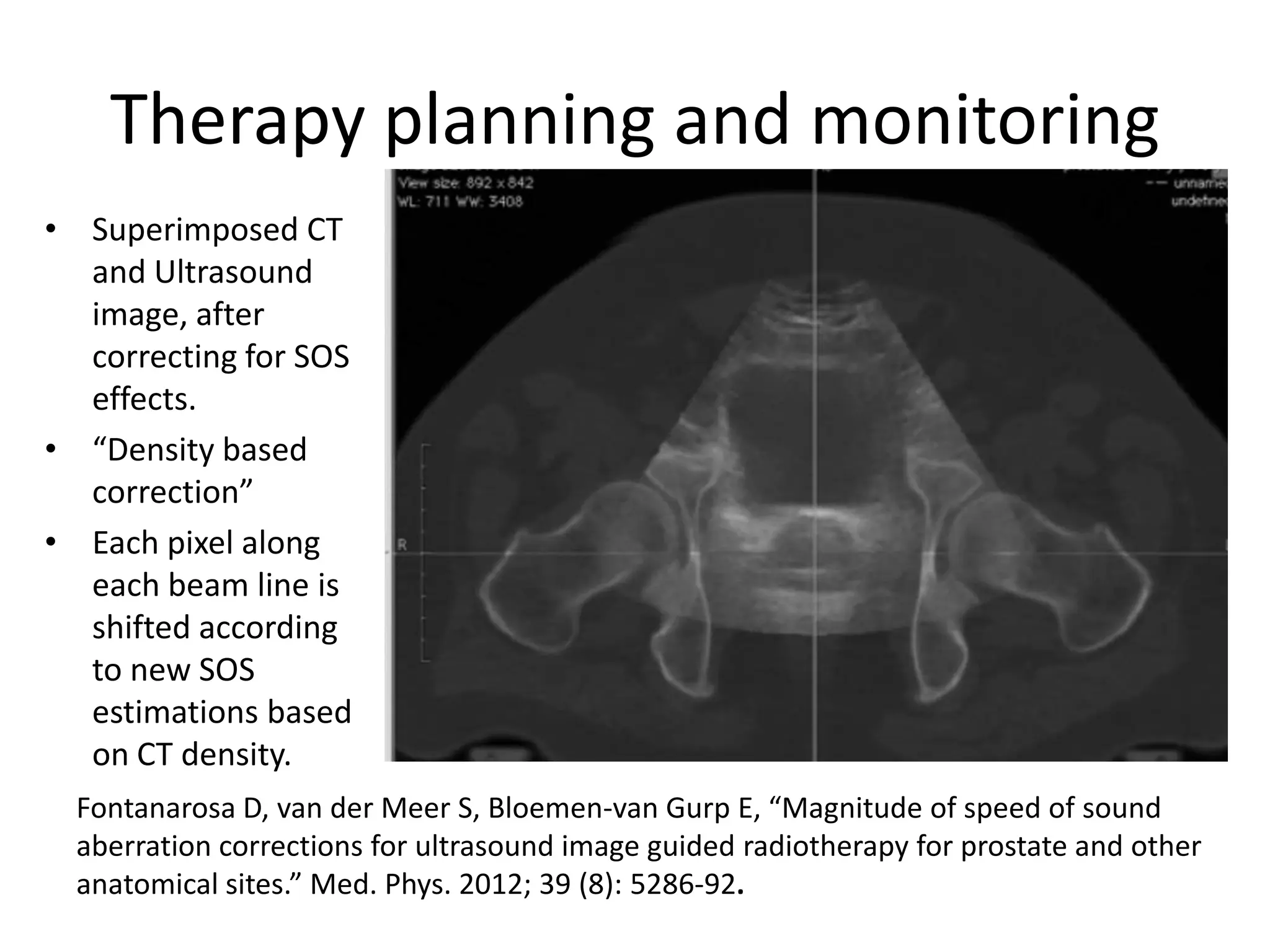 Reverberation Artifacts in ultrasound imaging | PDF