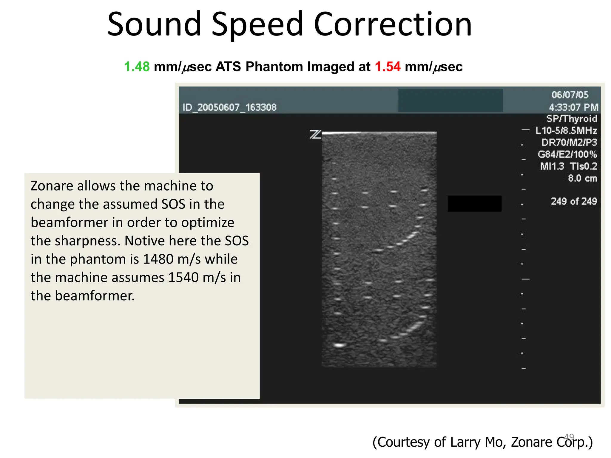 Reverberation Artifacts in ultrasound imaging | PDF