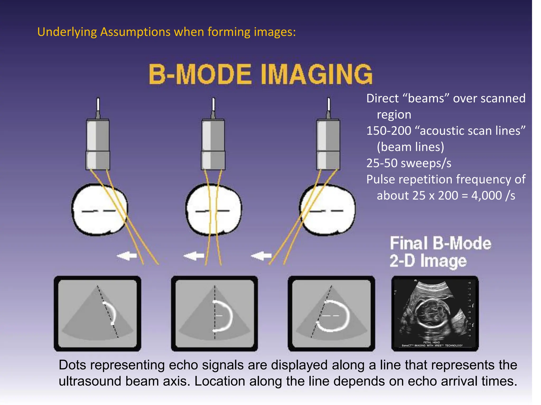 Reverberation Artifacts in ultrasound imaging | PDF
