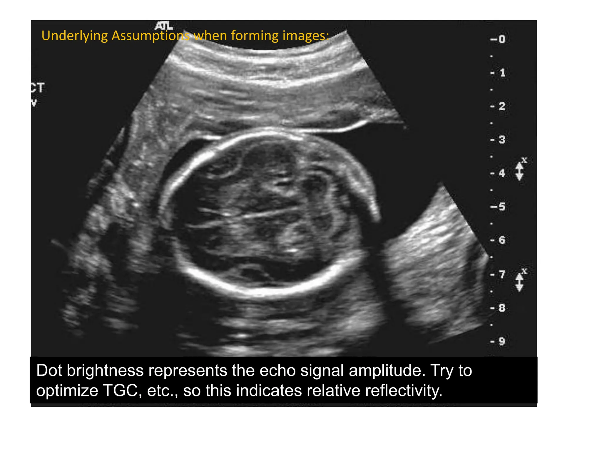 Reverberation Artifacts in ultrasound imaging | PDF