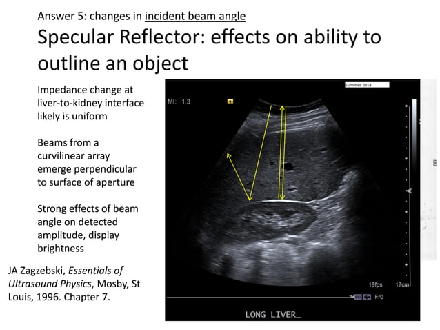Reverberation Artifacts in ultrasound imaging | PDF