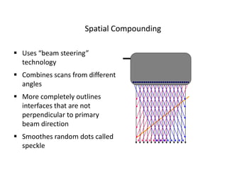 Reverberation Artifacts in ultrasound imaging | PDF