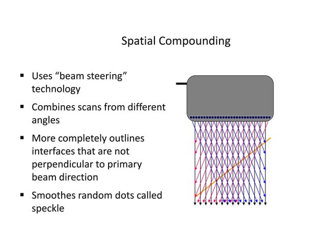 Reverberation Artifacts in ultrasound imaging | PDF