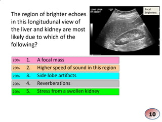 Reverberation Artifacts in ultrasound imaging | PDF