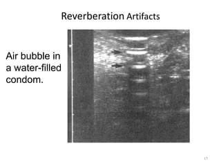 Reverberation Artifacts in ultrasound imaging | PDF