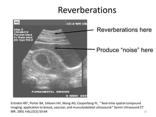 Reverberation Artifacts in ultrasound imaging | PDF