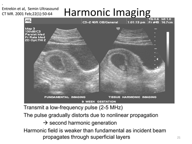 Reverberation Artifacts in ultrasound imaging | PDF
