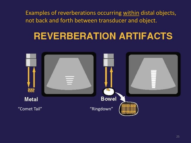 Reverberation Artifacts in ultrasound imaging | PDF