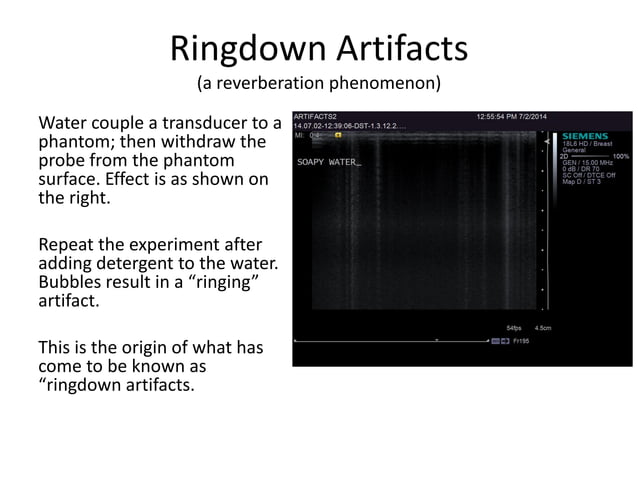 Reverberation Artifacts in ultrasound imaging | PDF
