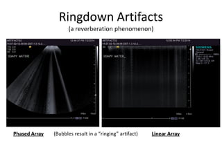 Reverberation Artifacts in ultrasound imaging | PDF