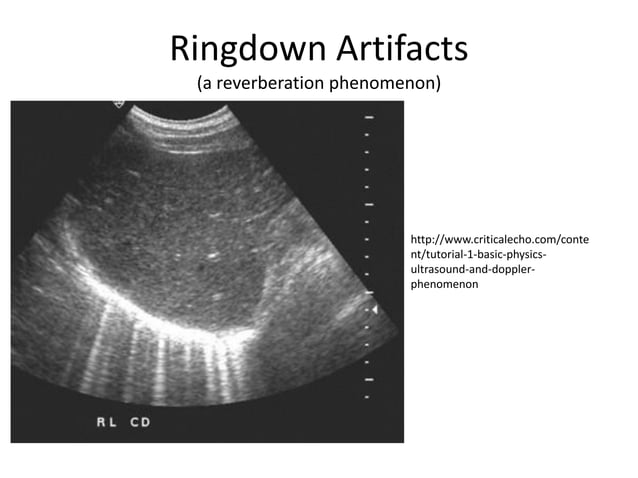 Reverberation Artifacts in ultrasound imaging | PDF