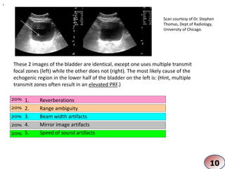 Reverberation Artifacts in ultrasound imaging | PDF