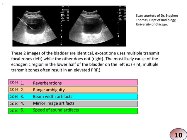 Reverberation Artifacts in ultrasound imaging | PDF