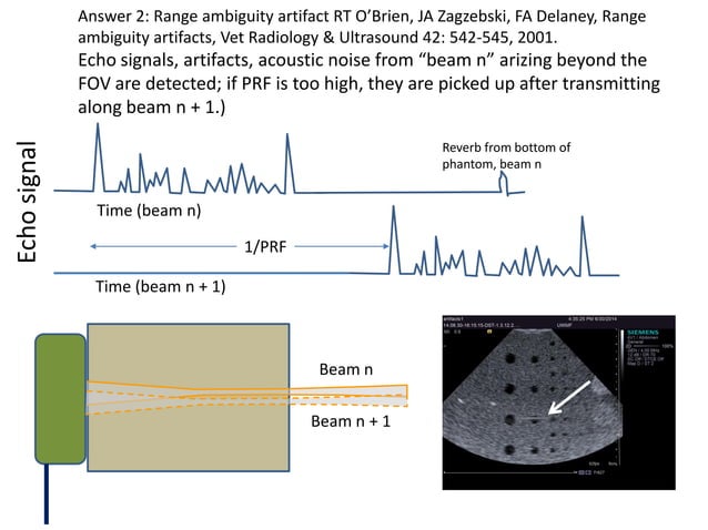 Reverberation Artifacts in ultrasound imaging | PDF
