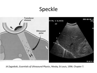 Reverberation Artifacts in ultrasound imaging | PDF