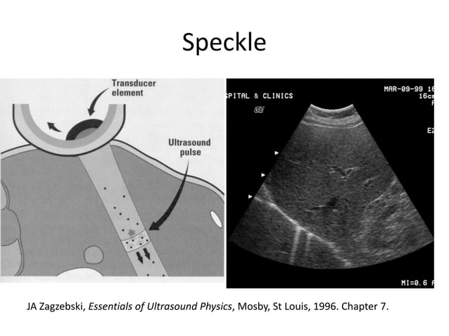 Reverberation Artifacts in ultrasound imaging | PDF