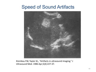 Reverberation Artifacts in ultrasound imaging | PDF