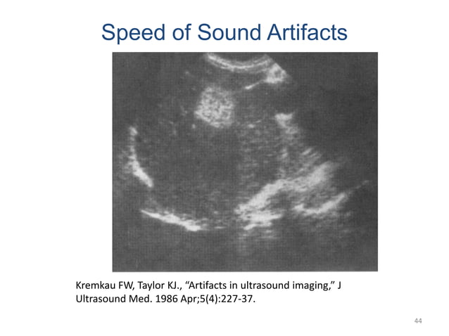 Reverberation Artifacts in ultrasound imaging | PDF