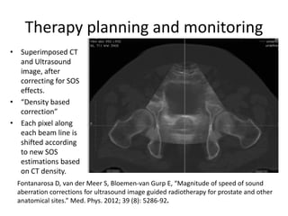 Reverberation Artifacts in ultrasound imaging | PDF