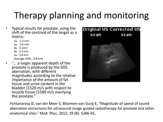 Reverberation Artifacts in ultrasound imaging | PDF