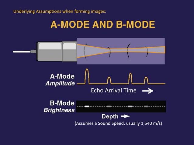 Reverberation Artifacts in ultrasound imaging | PDF