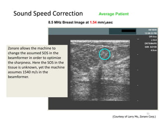 Reverberation Artifacts in ultrasound imaging | PDF