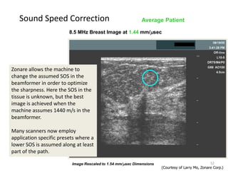 Reverberation Artifacts in ultrasound imaging | PDF