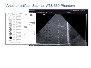 Reverberation Artifacts in ultrasound imaging | PDF