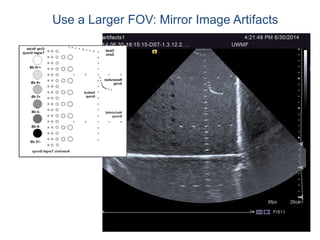 Reverberation Artifacts in ultrasound imaging | PDF