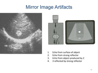 Reverberation Artifacts in ultrasound imaging | PDF