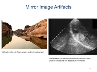 Reverberation Artifacts in ultrasound imaging | PDF