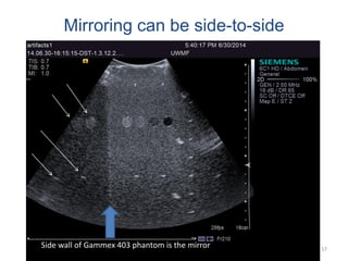 Reverberation Artifacts in ultrasound imaging | PDF