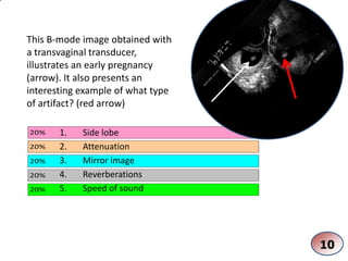Reverberation Artifacts in ultrasound imaging | PDF