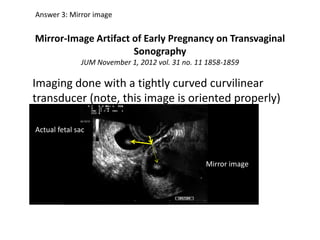 Reverberation Artifacts in ultrasound imaging | PDF