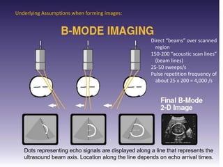 Reverberation Artifacts in ultrasound imaging | PDF