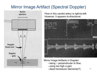 Reverberation Artifacts in ultrasound imaging | PDF